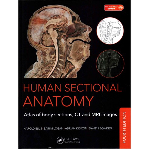Human Sectional Anatomy: Atlas of Body Sections CT and MRI Images, CRC ...